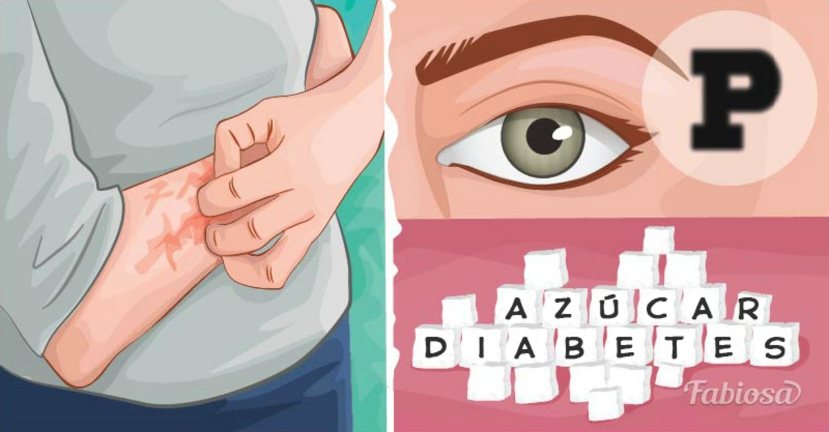 9 Síntomas Que Te Indican Que Tienes Un Elevado Nivel De Azúcar En El ...