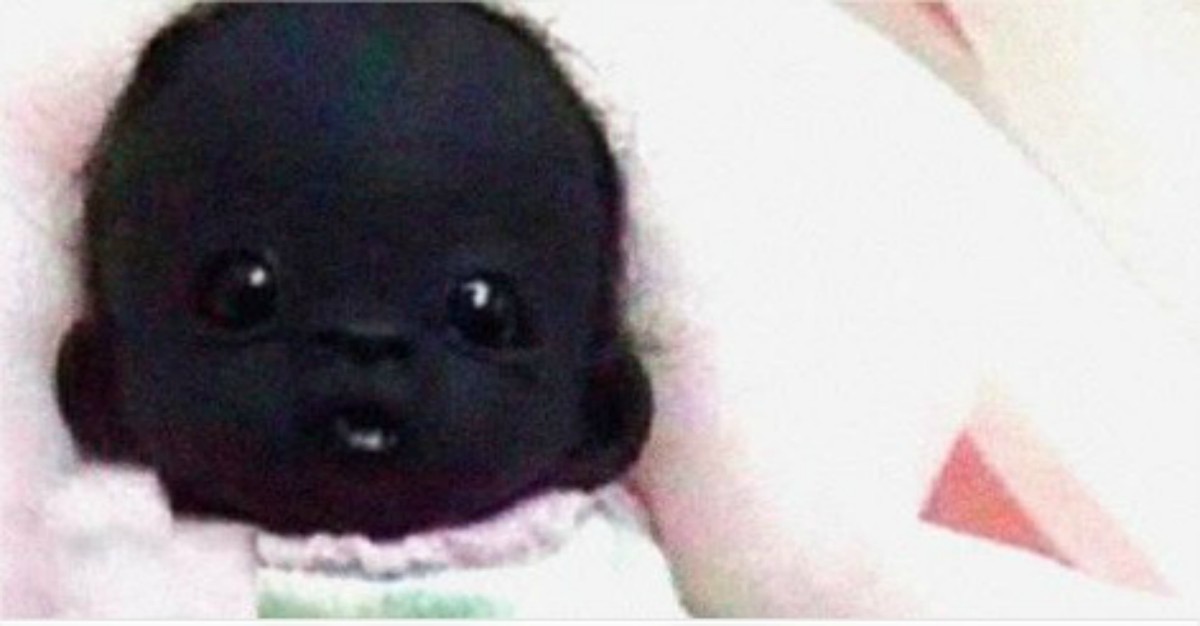 Mira Acá Cómo Luce Hoy El Llamado "Bebé Más Negro Del Mundo" ¡Ya Creció ...