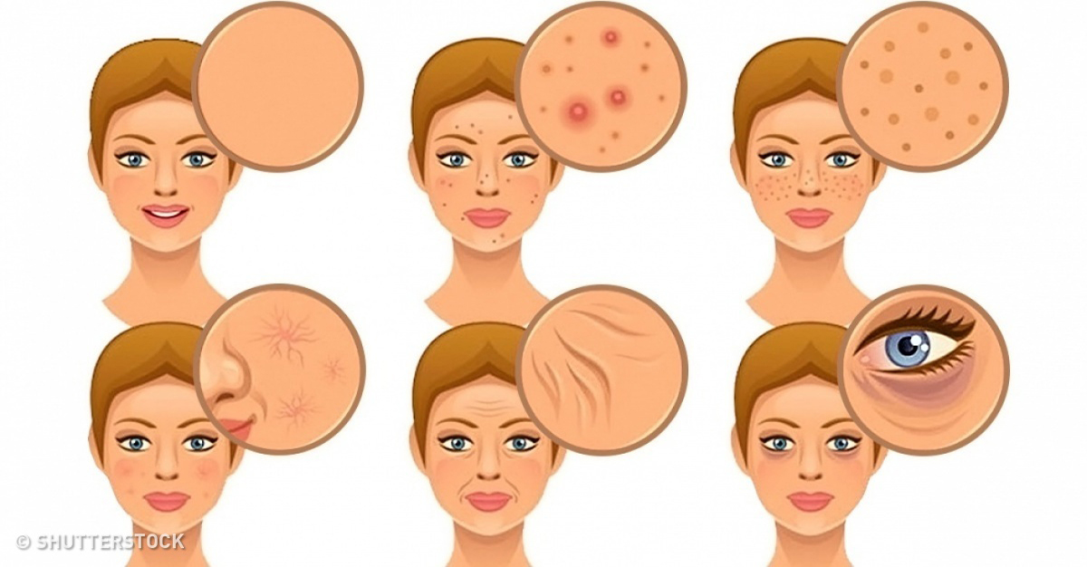 7 Alimentos Que Debes Evitar Por Ser Tóxicos Para Tu Piel - Via Ritmo