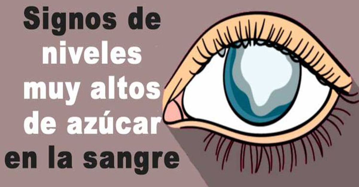 10 Signos De Tu Cuerpo Que Indican Un Alto Nivel De Azúcar En La Sangre ...