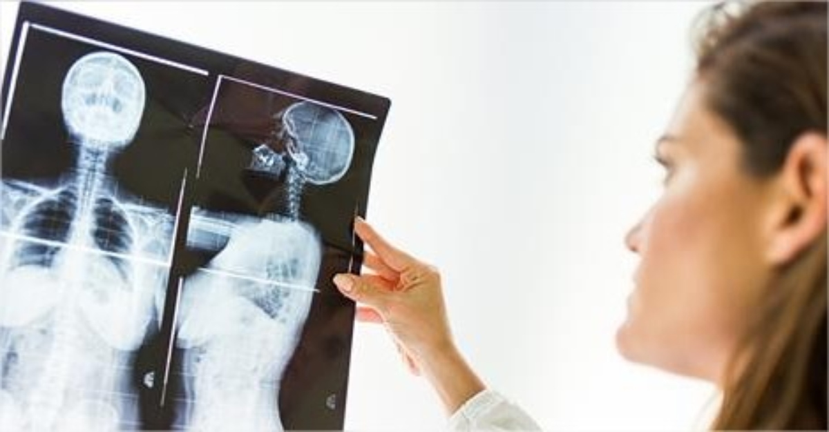 Curan Cáncer Avanzado Sin Quimioterapia. Una Luz De Esperanza Para ...