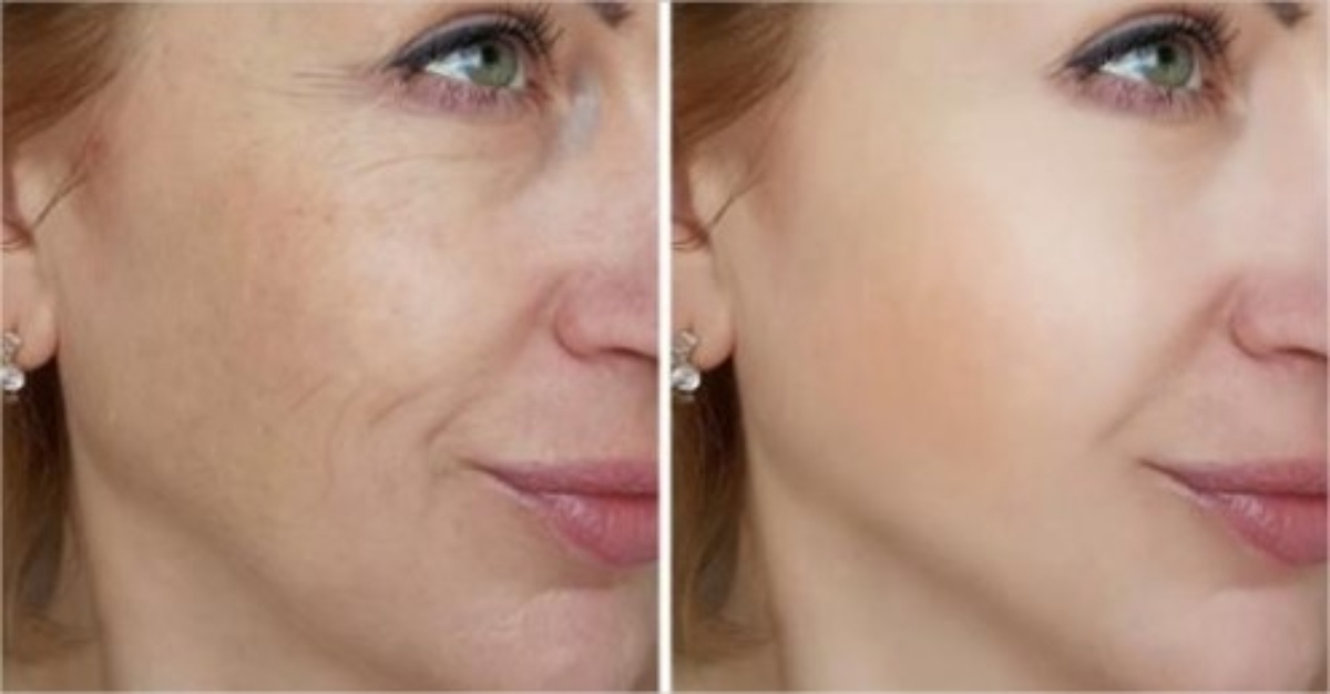 Sigue Este Consejo Y Eliminarás Las Arrugas Del Rostro Con Este Simple ... Sigue Este Consejo Y Eliminarás Las Arrugas Del Rostro Con Este Simple ...